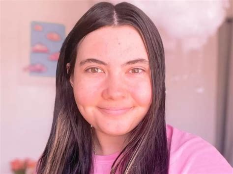 This California Woman Is Allergic To Water