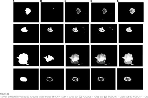 Figure 11 From A Deep Learning Model For The Localization And