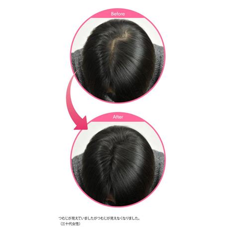 マジックパウダー 50g ブラック【薄毛隠し 薄毛カバー 薄毛対策 白髪隠し 白髪カバー 瞬間増毛 増毛 男女兼用 円形脱毛 クラウン