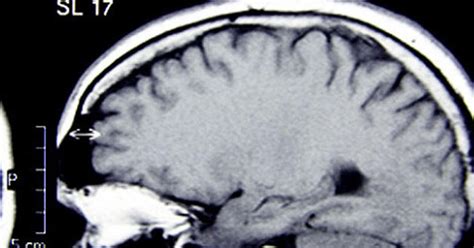 New Research On Sex Addicts Brains Cbs News