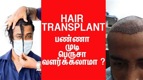 Ultra Bio Hair Transplant Clinic
