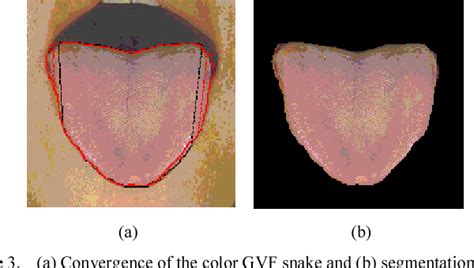 Figure From Color Active Contour Models Based Tongue Segmentation In Traditional Chinese