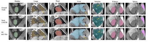Example Of The Median Scored Case In Mouse Multi Organ Segmentation In