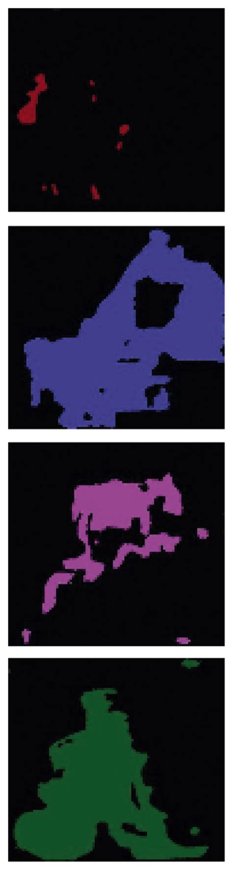 Comparison Of Segmentation Effects A Sample Image B Model C