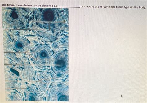 Solved The Tissue Shown Below Can Be Classified As Tissue Chegg Com