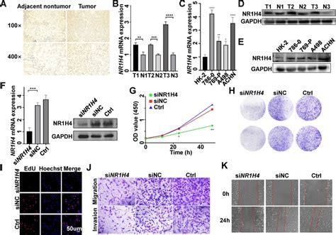 Knockdown Of Nr1h4 Suppressed Proliferation Migration And Invasion Of