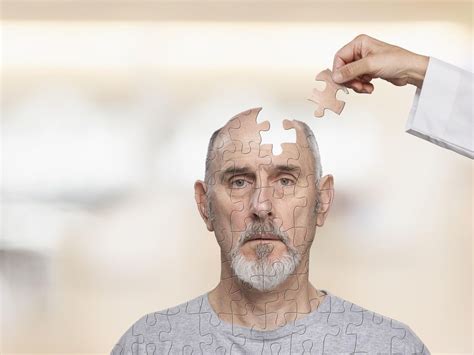 Salud Los científicos encuentran un posible origen del alzhéimer y ahora podría curarse