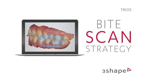 3shape Trios Scan Strategy Bite Youtube