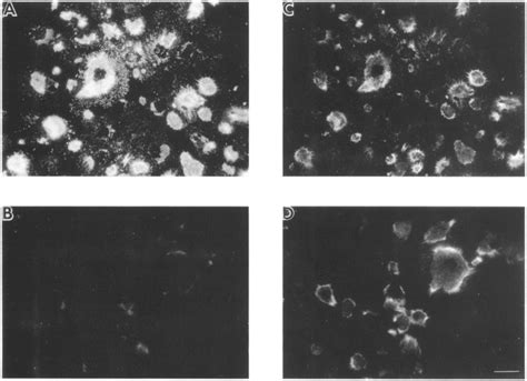 Organization Of Vinculin And Actin In Vinculin Transfected Asml Cells Download Scientific