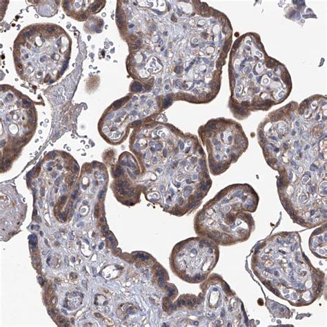 Rabbit Polyclonal Anti Sms Antibody Buy For Research Highly