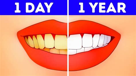 What Happens If You Stop Brushing Your Teeth Youtube