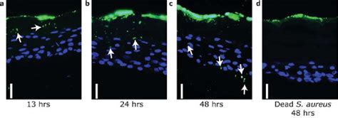 Figure 2 From Staphylococcus Aureus Exploits Epidermal Barrier Defects