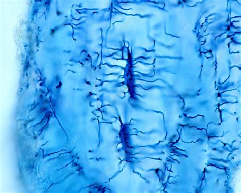 Osteocytes Light Micrograph Stock Image C0528850 Science Photo