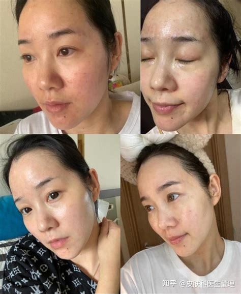 有哪些美白产品是让你用了会「疯狂推荐」给大家？ 知乎