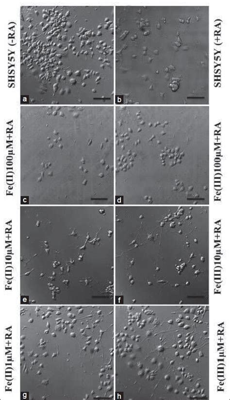 Investigation Of In Vitro Cytotoxicity Of The Redox State Of Ionic Iron In Neuroblastoma Cells