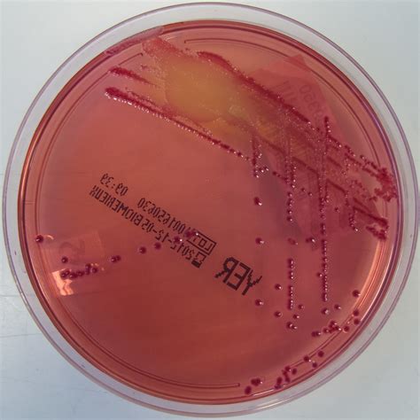 Yersinia Enterocolitica Growing On Cin Agar Yersinia En Flickr