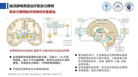 张建国教授：运动障碍性疾病的环路机制研究及调控干预 脑医汇