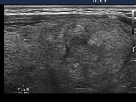 Selected Topics Differentiation Of Discrete Lesions