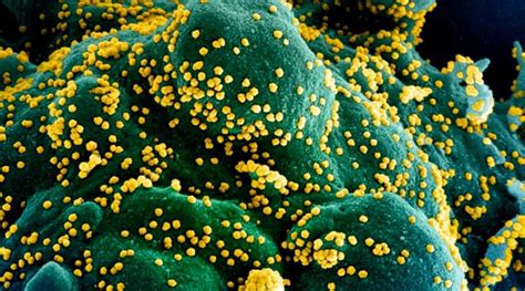Terapia Antiviral Muestra Resultados Prometedores Como Posible