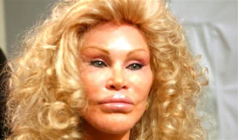 Before Plastic Surgery The Unusual Looking Woman Looked Like This