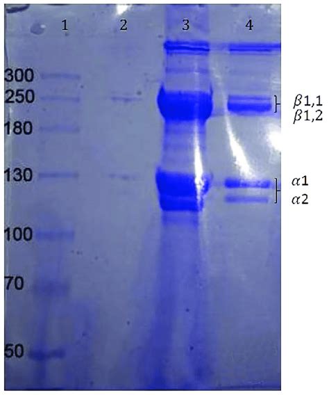 Electrophoretic Migration Patterns Of Control Avian Collagen And