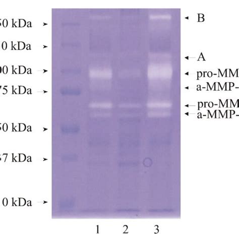 Zymogram Shows The Ability Of Gelatin Degradation By Proteins Contained