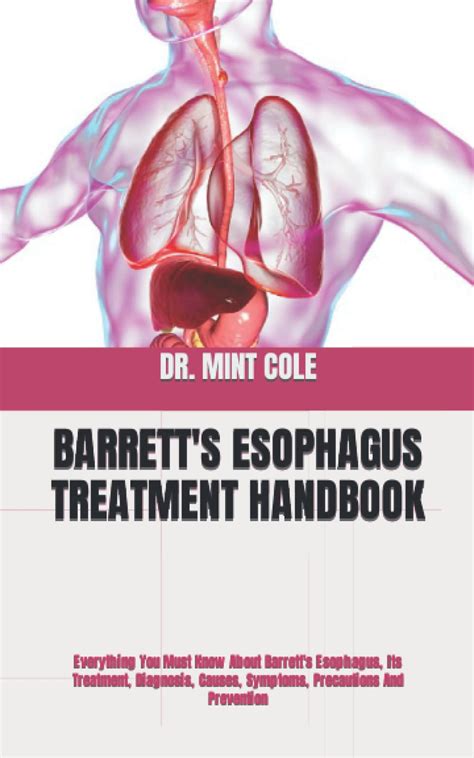 Barretts Esophagus Treatment Handbook Everything You Must Know About
