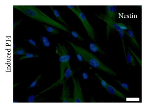 Morphology And Expression Of Neural Specific Genes And Protein In Wj Download Scientific