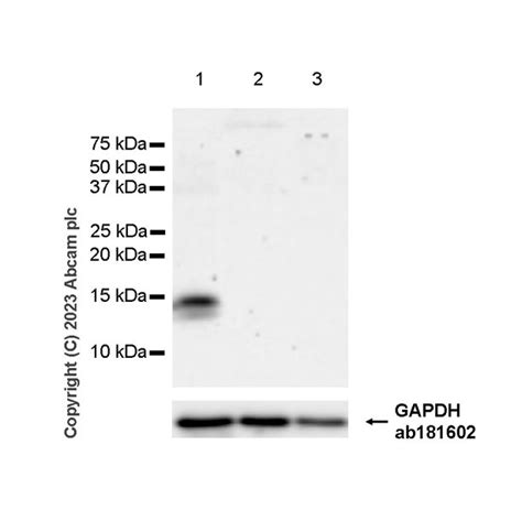 Osteocalcin重组抗体 Epr24665 63 Osteocalcin抗体ab309521