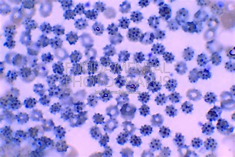 Red Blood Cells Microscope Hypertonic