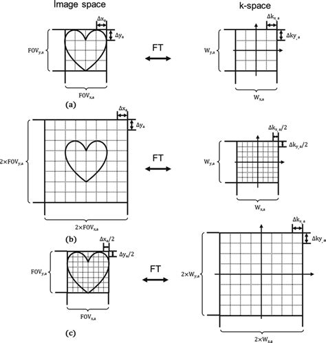 Spatial Temporal Resolution And Signal To Noise Ratio Thoracic Key