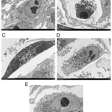 OMT inhibits TGF β1 induced ultrastructural changes in A549 cells A