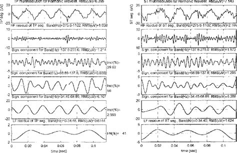 Figure 1 From A Multiresolution Wavelet Method For Characterisation Of Ventricular Late