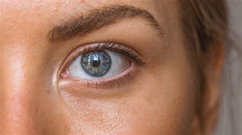 Hordeolum Stye
