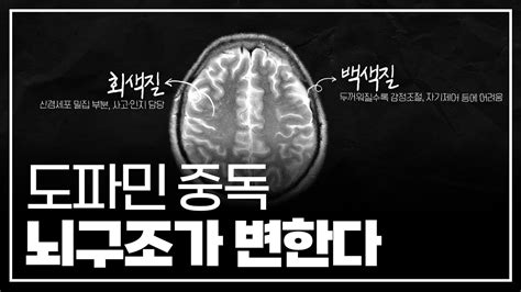 마약 수준의 중독성 숏폼ㅣ뇌가 쉬지 못하면 벌어지는 일ㅣ팝콘브레인ㅣ지식핫플 Youtube