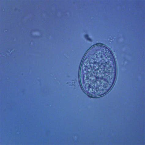 Diphyllobothrium Latum Eggs W M Microscope Slide Carolina Biological Supply