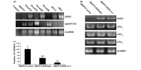 Kiss1 Expression Inhibits Skov3 Cell Migration A Differential