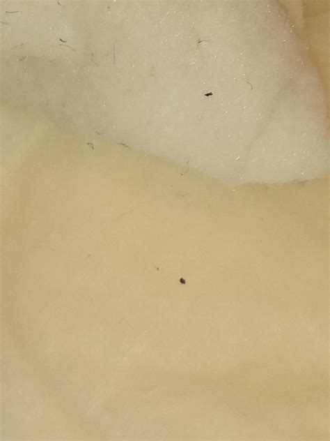 Tiny Black Specks Everywhere Please Help R Whatisthis