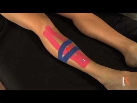 Kt Tape Shin Splints Anterior Artofit