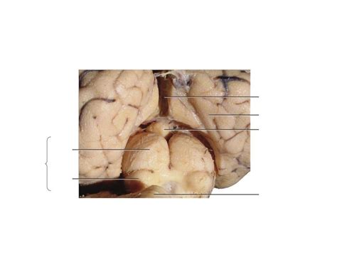Posterior Inferior Sheep Brain Quiz