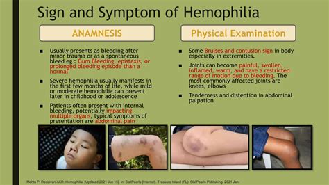 Circumcision Procedure In Hemophilia Patients Revisionpptx