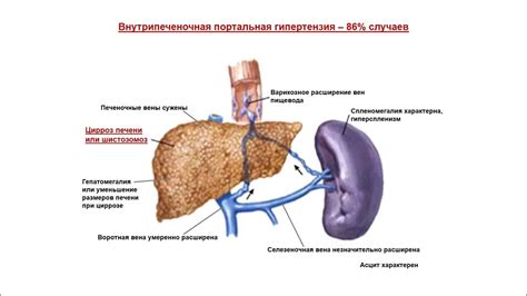 УЗИ Доктор Иогансен Выпуск 15 Портальная гипертензия Часть 1 Youtube