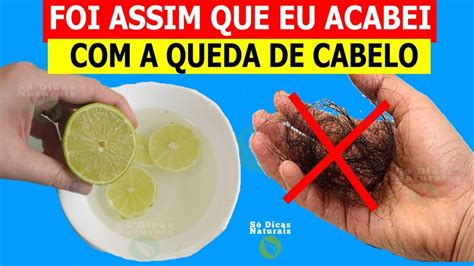 QUEDA DE CABELO RECEITA CASEIRA Para ACABAR A Queda De Cabelo YouTube