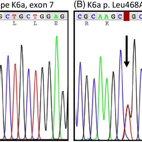 a wildtype dna sequence of exon 7 nucleotides 1 396 1 410 of the