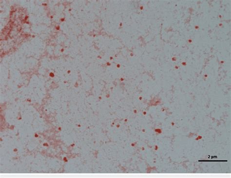 One Colony Forming Unit Cfu Of Yeast Isolated Under Light Microscopy
