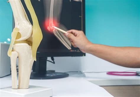 Premium Photo Close Up Blurred Hand Doctor Point Xray Knee On Monitor