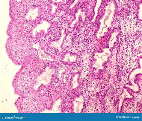 Endometrium Secretory Phase Royalty Free Stock Image Cartoondealer