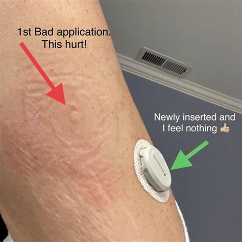 I Don T Think My Chart Is Supposed To Look Like This R Dexcom