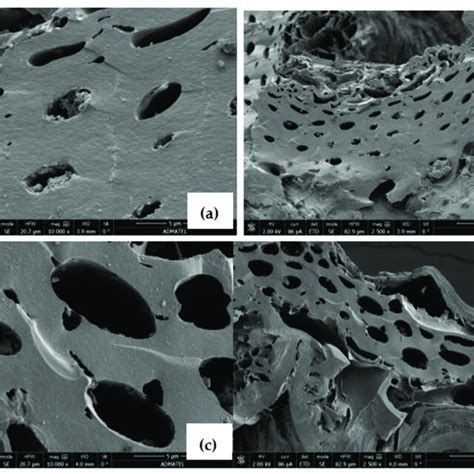 Sem Image Of Rhac At A 10000× Magnification And B 2500×