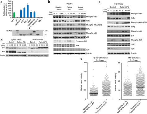Enhanced NF κB signaling in transiently transfected 293T cells and